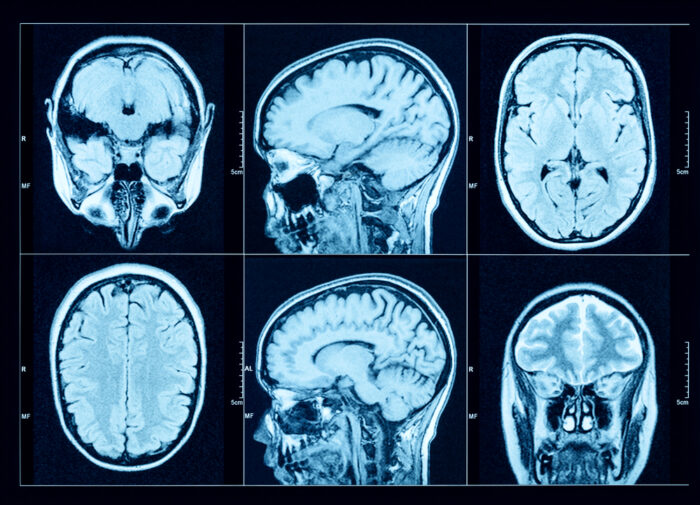 Imaging Center in Dallas, TX | Southwest Diagnostic Center